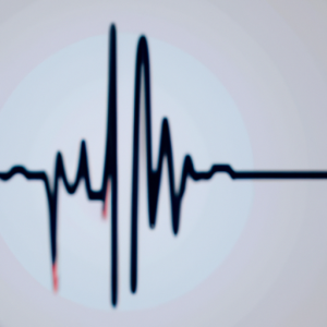 Heartbeat Sound in The Ear Symptom, Causes & Questions – San Diego Health