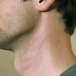 Neck Swelling on One Side Symptoms, Causes & Common … – San Diego Health