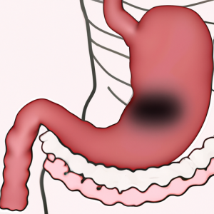 Stomach Spasms & How to Treat Them: – San Diego Health