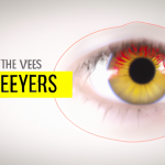 6 Causes of Yellow Eyes: When to See a Doctor – San Diego Health
