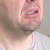 Pain and Sore Roof of Mouth: 4 Causes & Treatments – San Diego Health